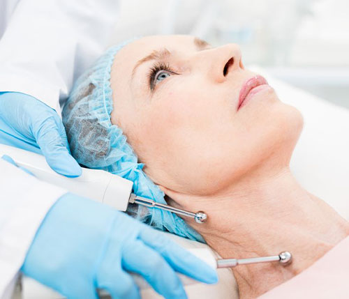 Neck Lift | Oxygen Clinic
